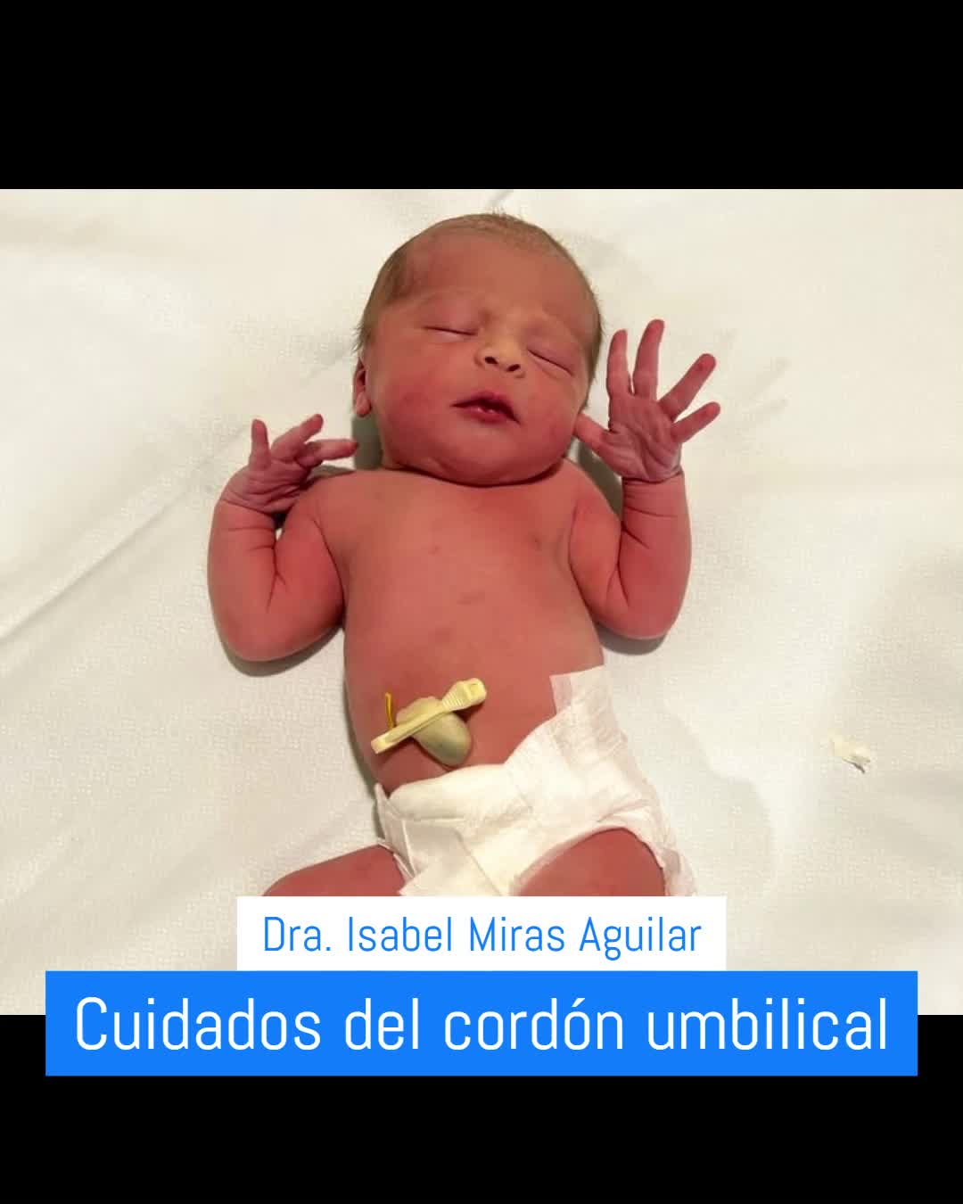 Cuidados del cordón umbilical en recién nacidos: guía segura para ...